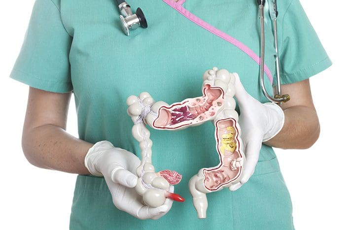 Inflammatory Bowel Disease and Intestinal Permeability | EP Back Clinic