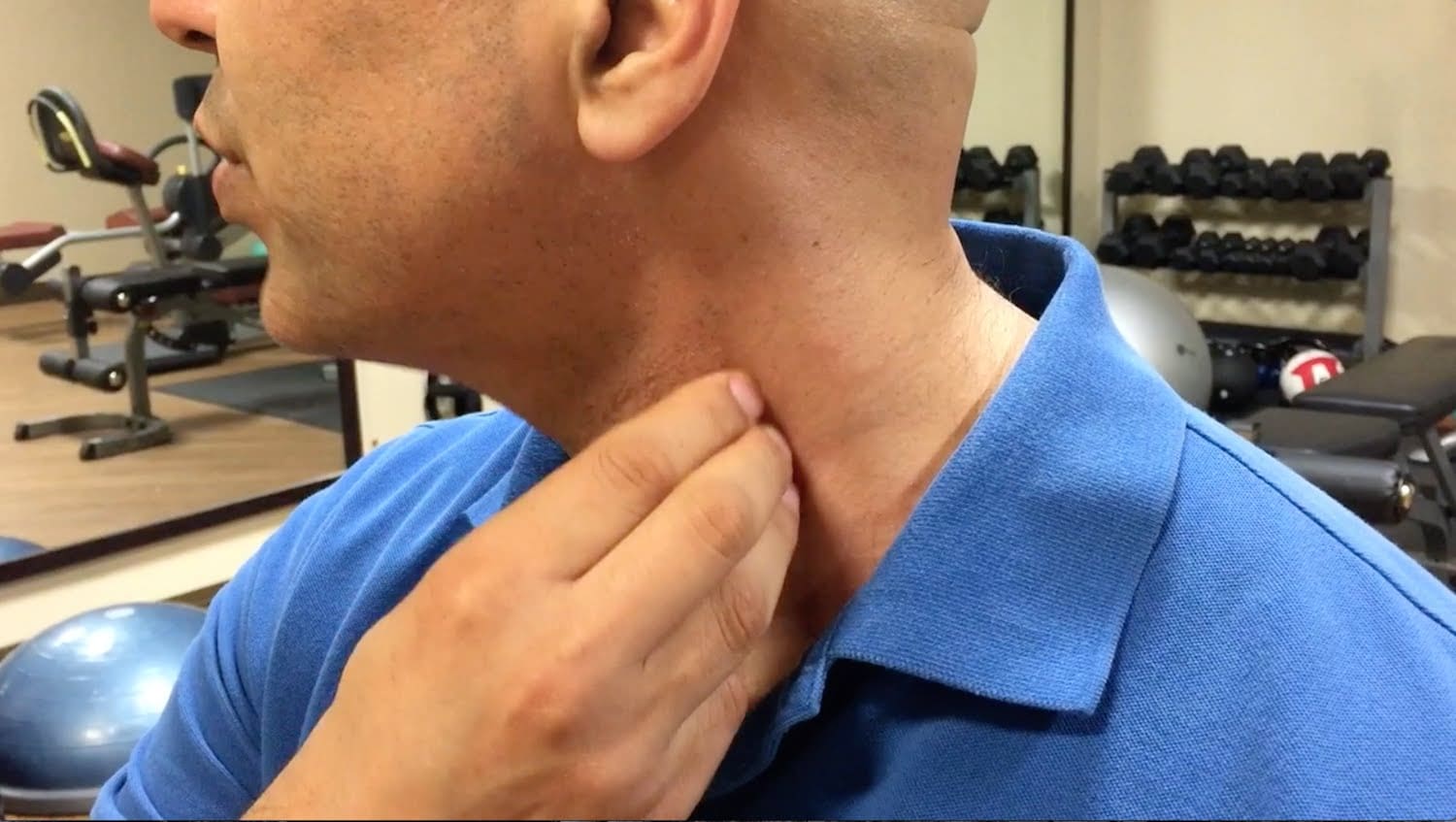 Scalenes Trigger Points