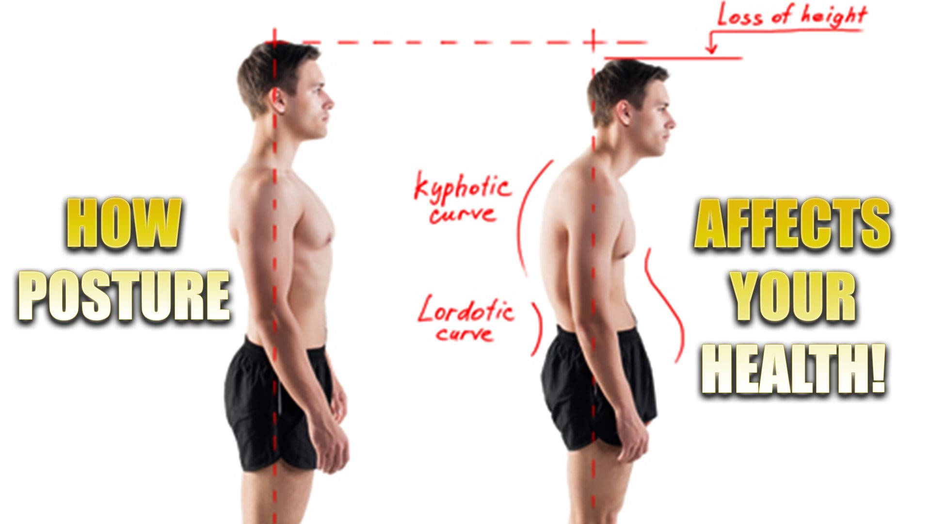 Posture Affects Your Health | El Paso, TX. | Doctor Of Chiropractic